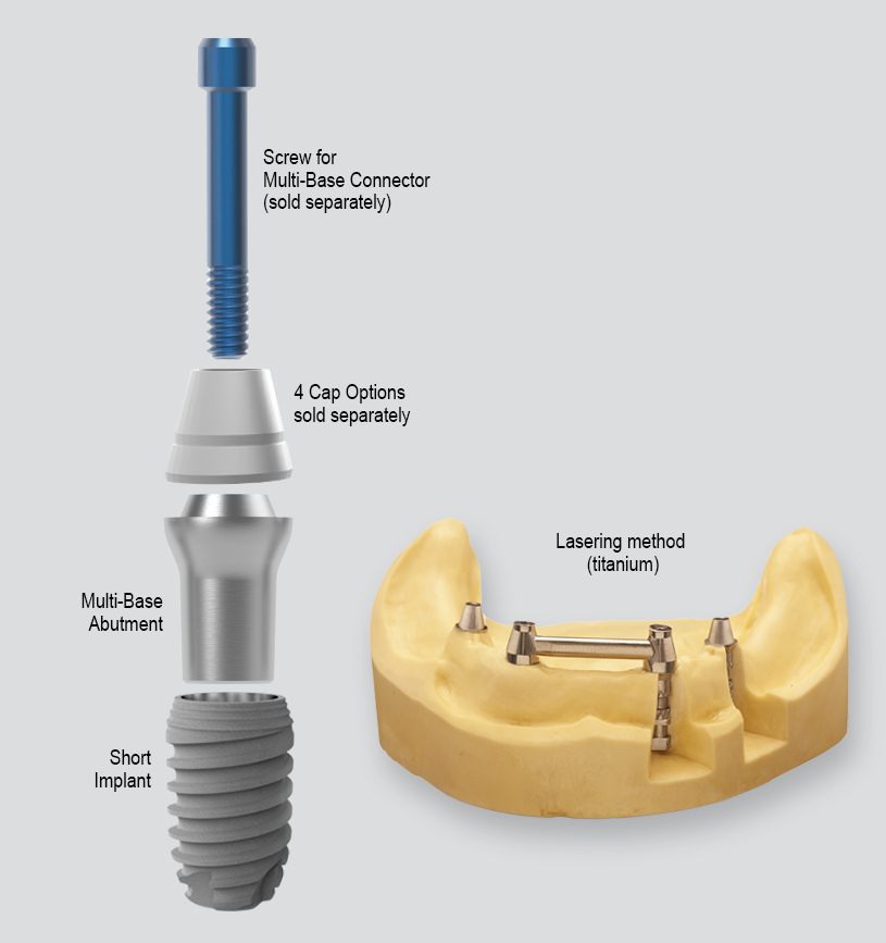 Short Platform- Blue|Argon K3Pro Conical Implants