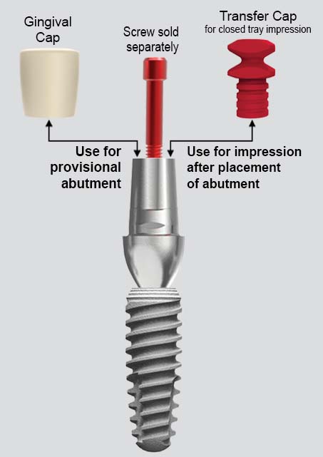 2mm Preform- Red|Argon K3Pro Conical Implants